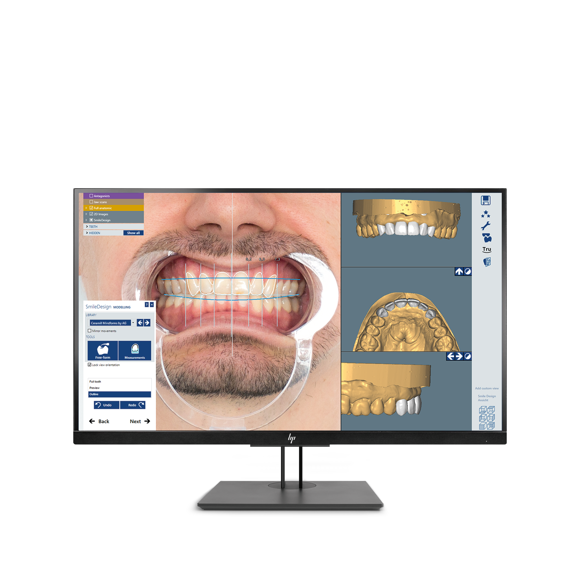 Ceramill M-Smile | Amann Girrbach
