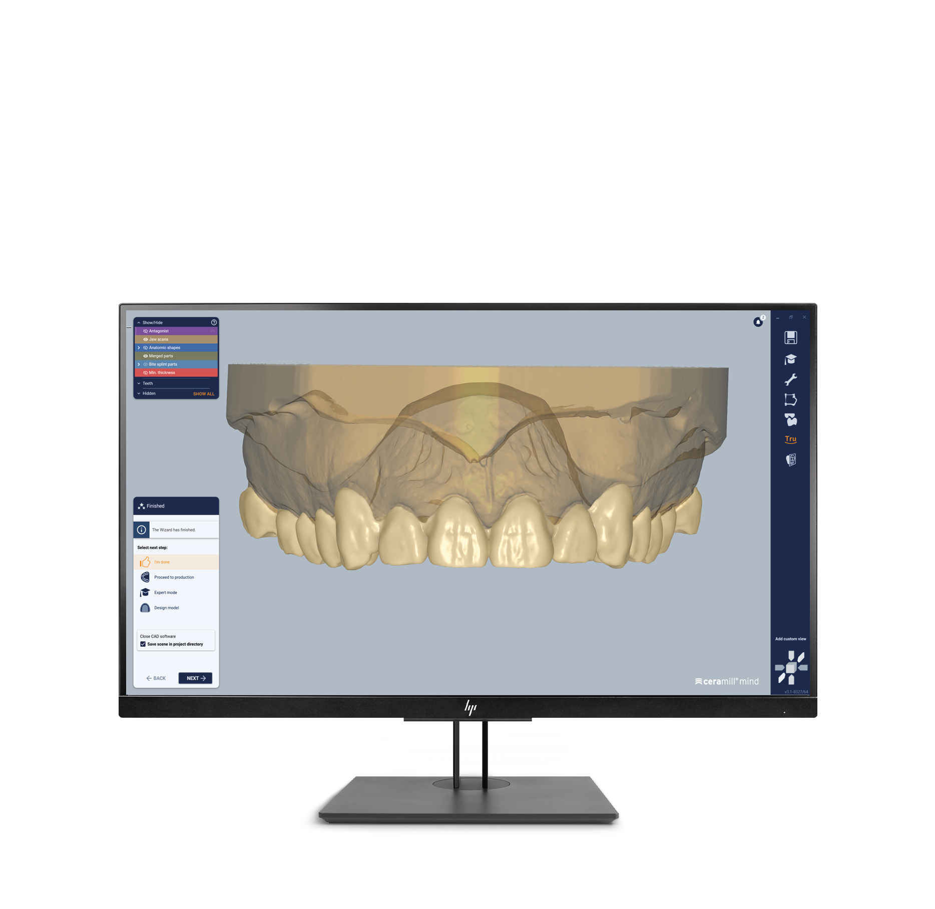 Ceramill Map FX | Amann Girrbach