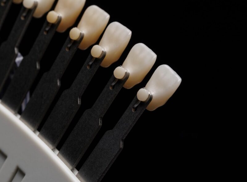 Zolid Bion Shade Guide: Perfect shade matching – now with an even ...