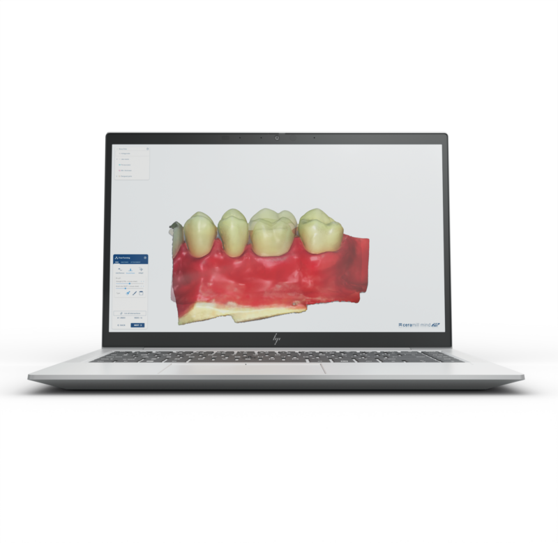 Software - Amann Girrbach North America