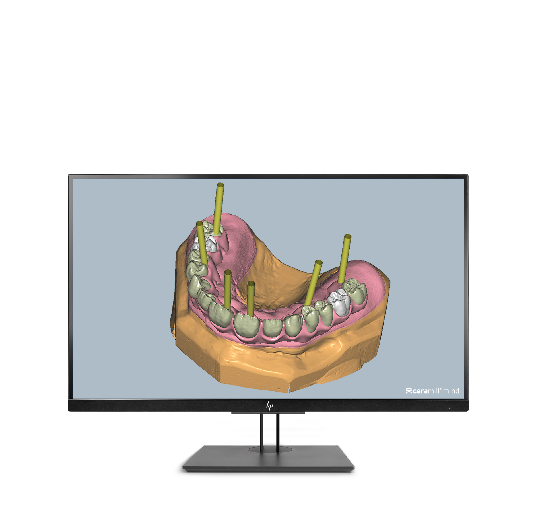 Ceramill M-Gin - Amann Girrbach